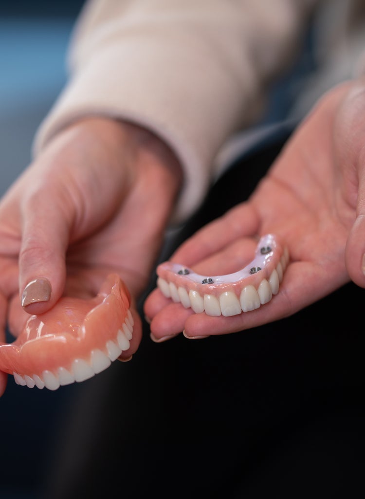 Partial dentures vs dental implants: how they compare (cost, comfort ...