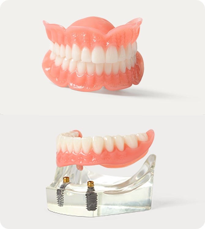Apicoectomy: root canal surgery explained | Aspen Dental