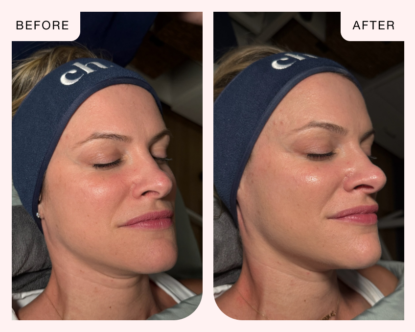 Med Spa in Chicago, IL | Chapter Aesthetic Studio