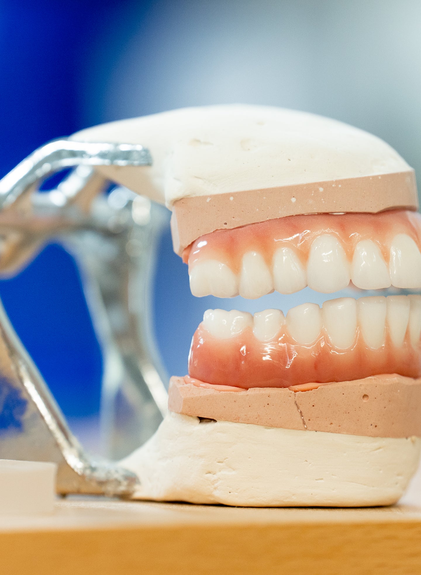 Why choose zirconia arches for fixed full arch dental implants ...
