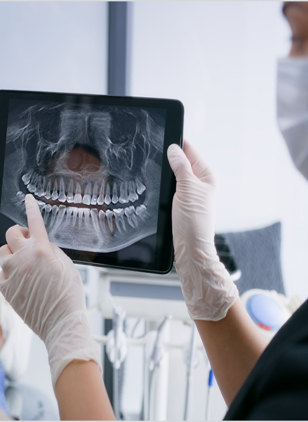 How Soon Can a Bridge Be Placed After Tooth Extraction? | ClearChoice