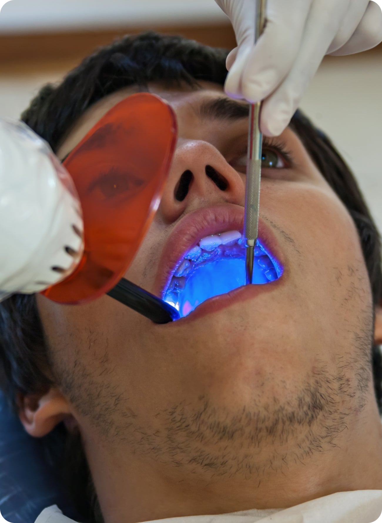 Root canal recovery: what to expect | Aspen Dental