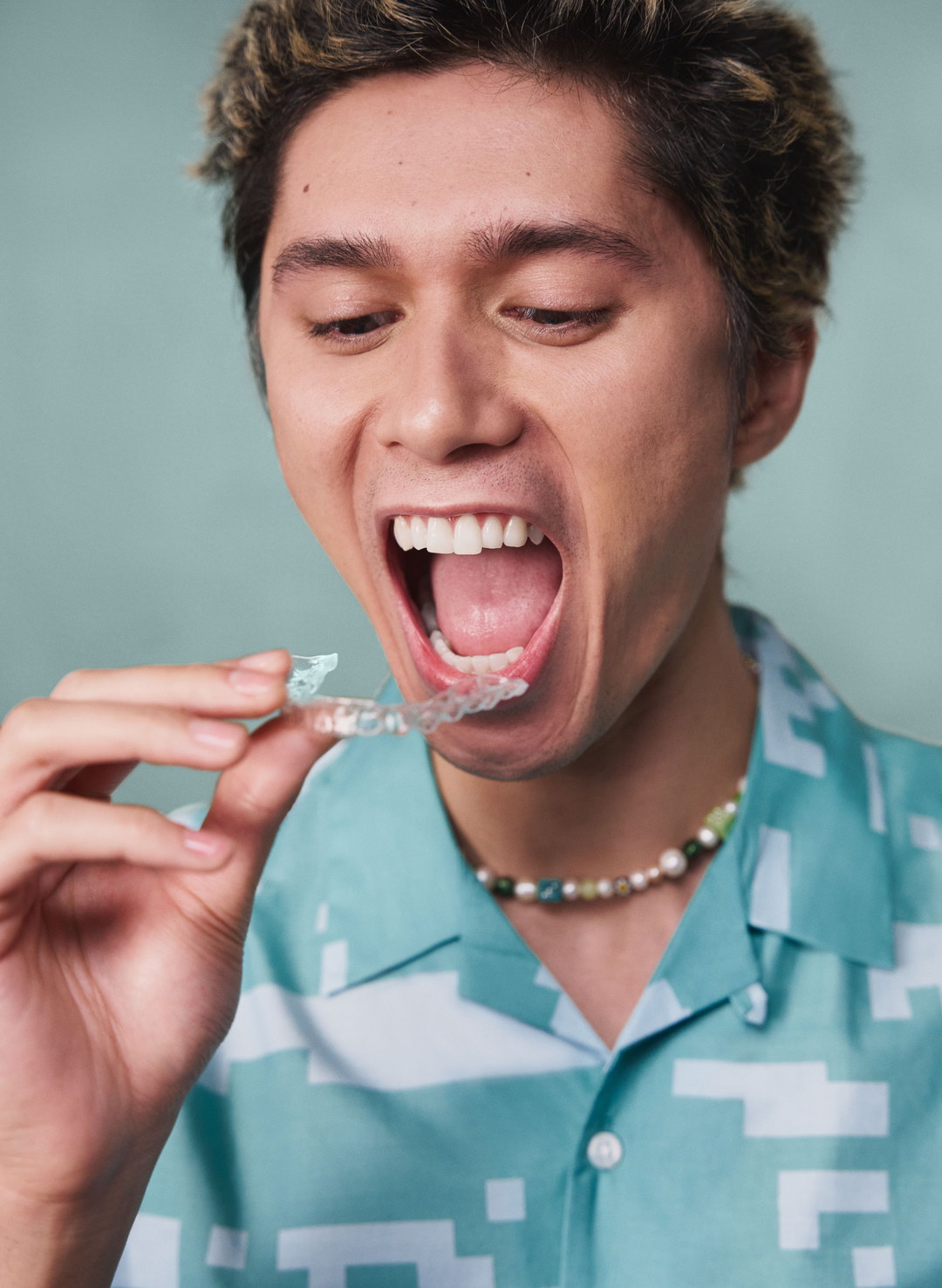 Why Do You Need a Retainer After Braces? | Motto Aligners