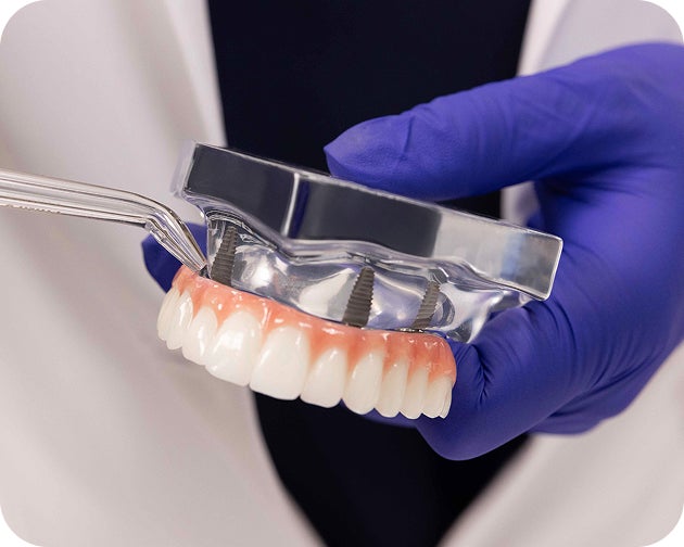 How to Clean Dental Implants | Aspen Dental’s Expert Guide