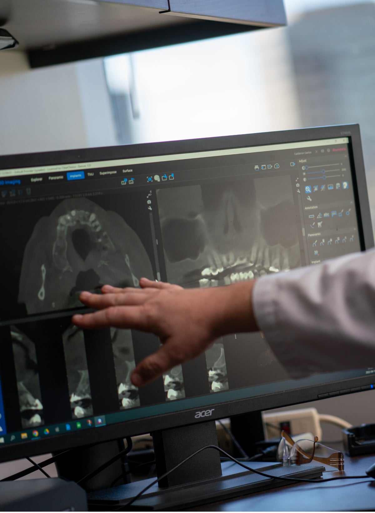 How much do molar implants cost? | ClearChoice