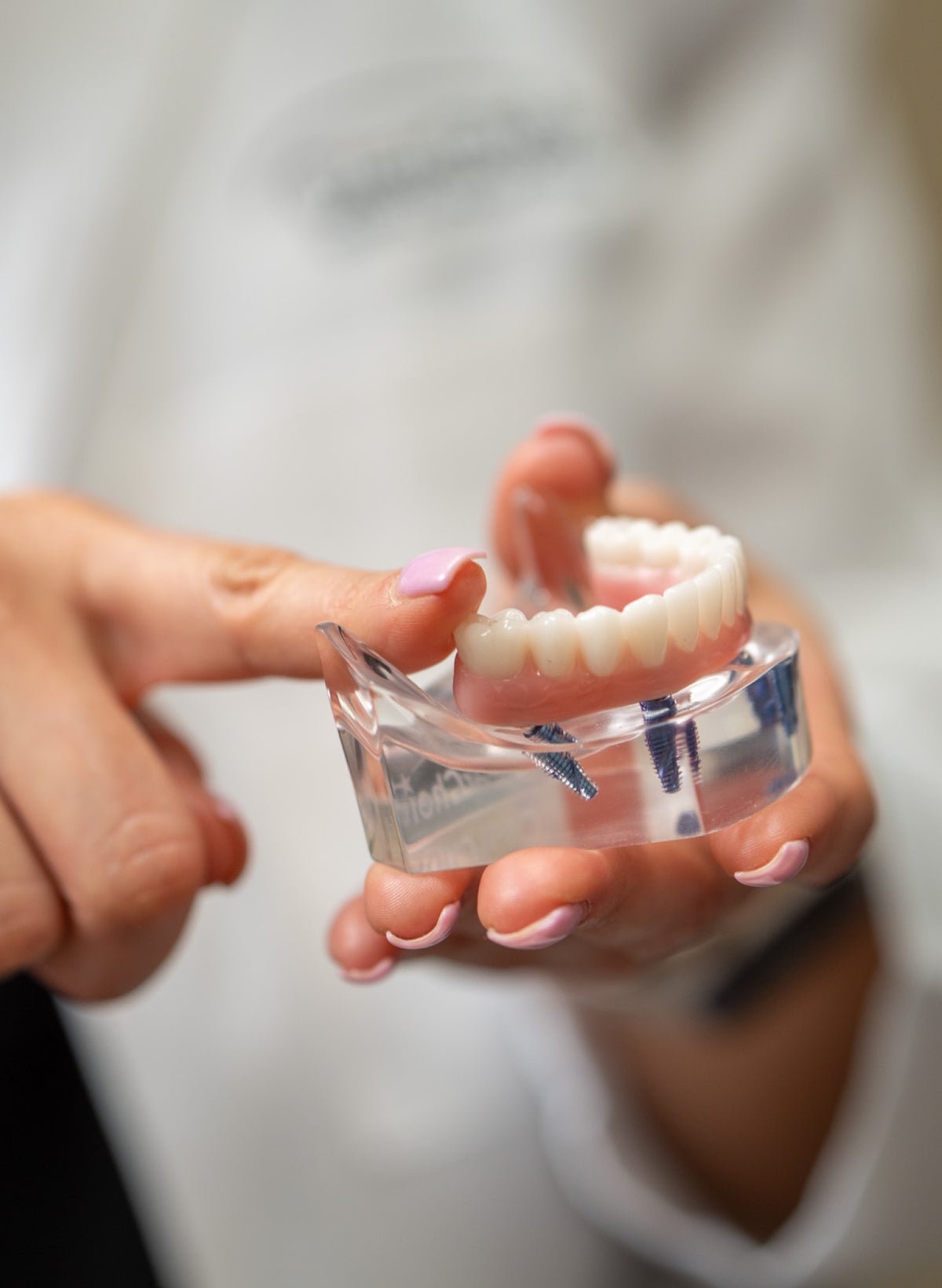 Dental bridges vs. implants: Which is best for you? | ClearChoice