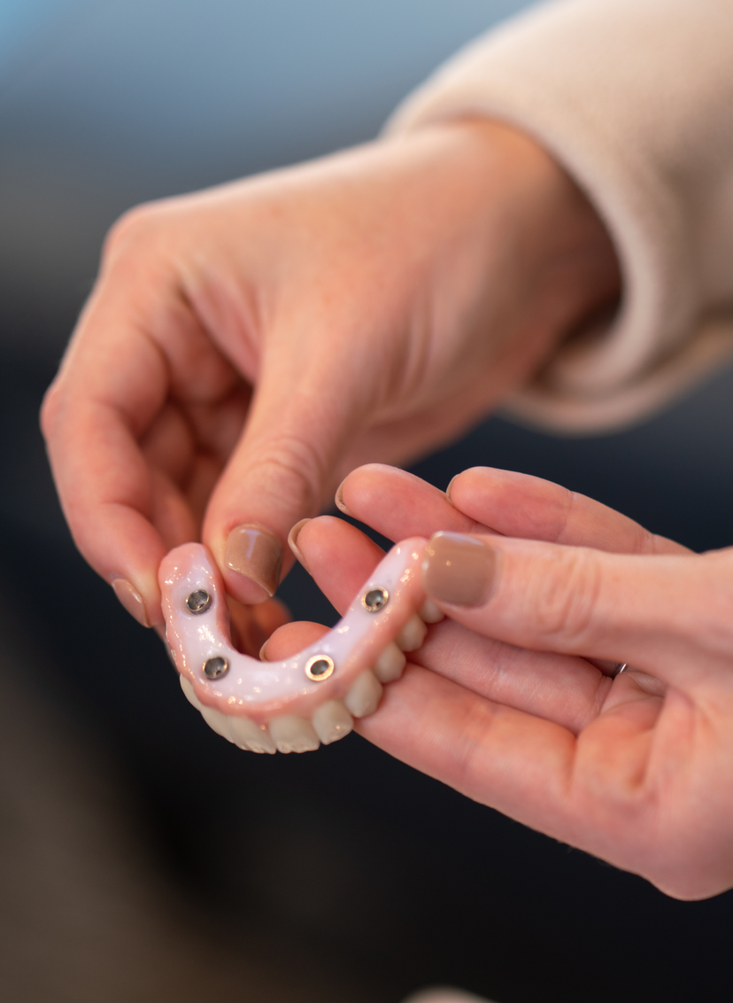 Endosteal Dental Implants: Benefits, Types & Procedure | ClearChoice