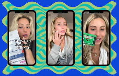 Everything We Know About Alix Earle's Accutane Experience