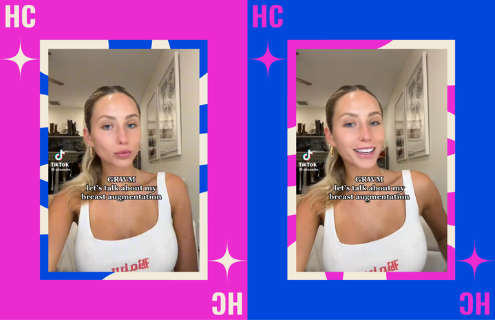 I’m Obsessed With Alix Earle Celebrating Her “Boobaversary”