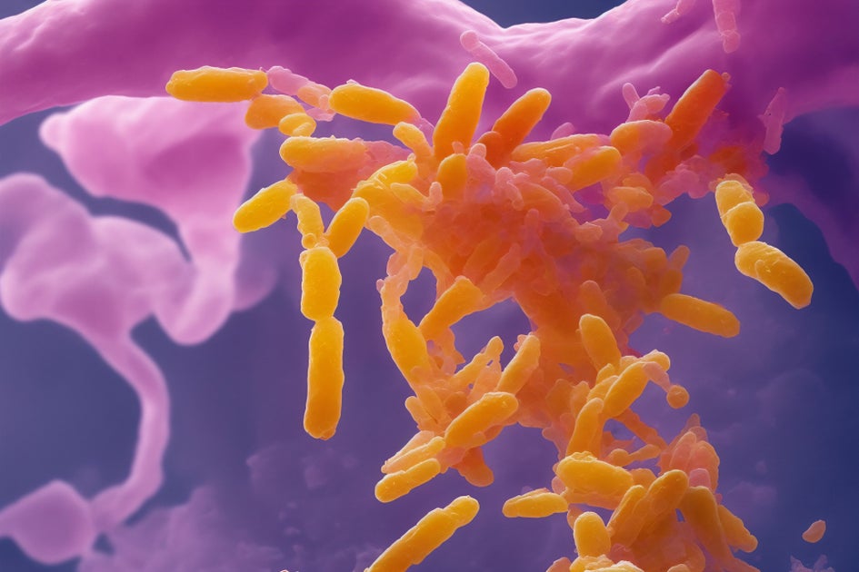 Listeria Hygiena listeria-hygiena